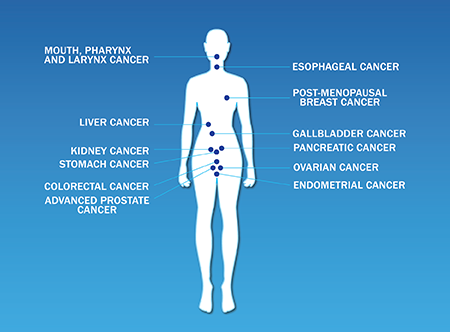 A Growing Global Problem: Excess Body Weight and the Associated Cancer ...
