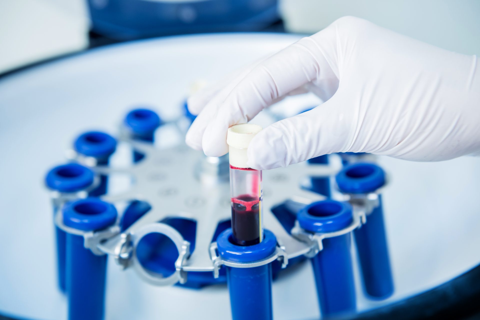 Liquid Biopsies: A Revolution in Early Cancer Detection and Monitoring ...